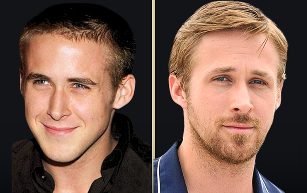 ryan-gosling-plastic-surgery-the-hollywood-rumors-explored-rememore